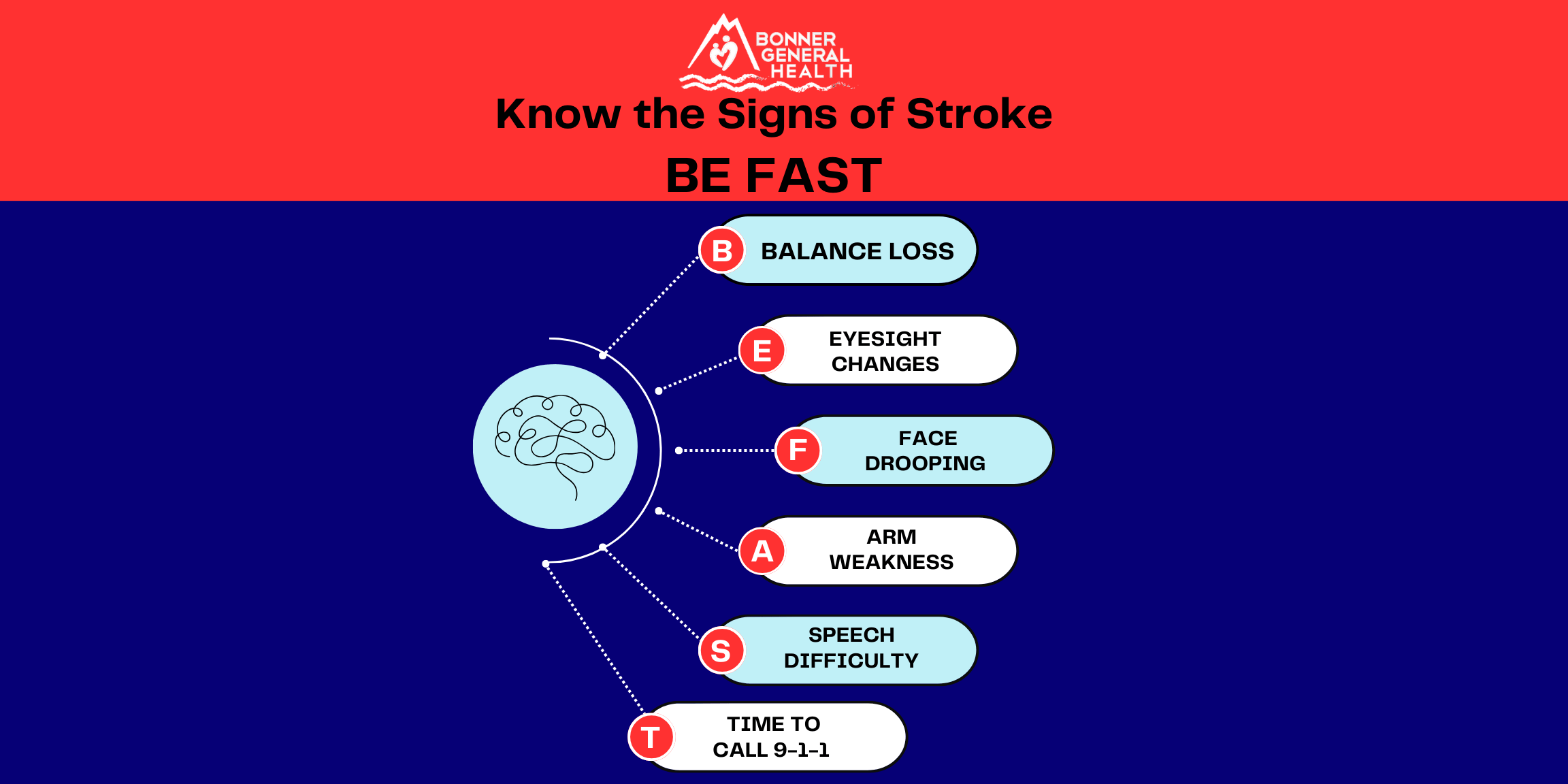 Be fast when a stroke is suspected. - Bonner General Health